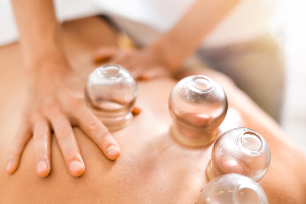 Cupping Therapy & Benefits